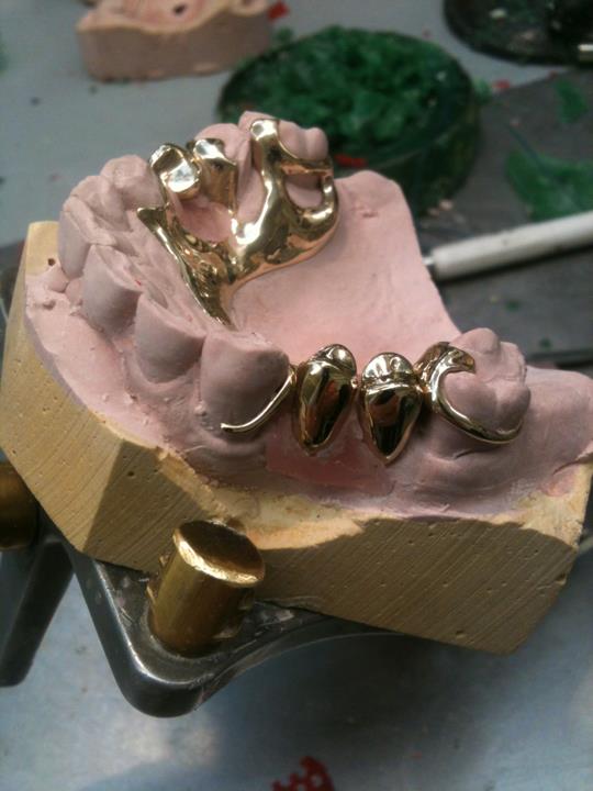 Gold frameworks | McDowell