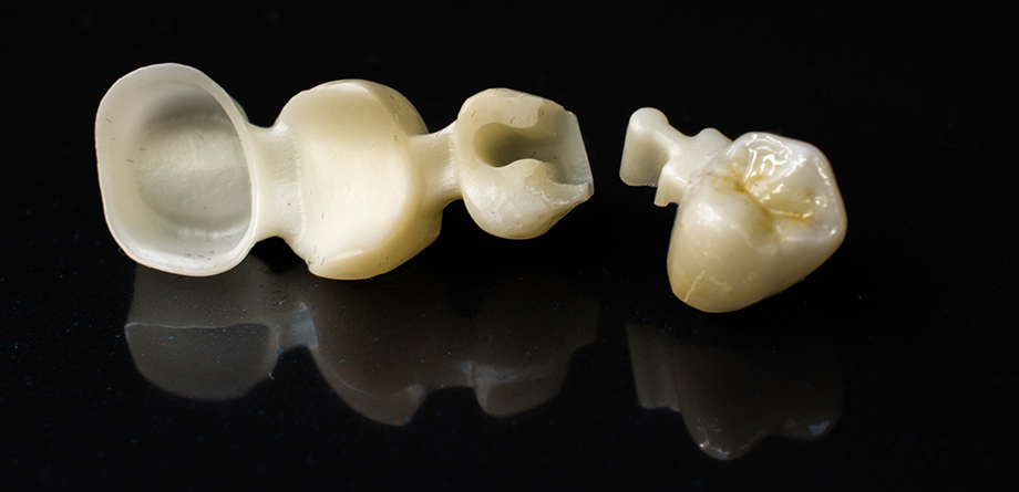 McDowell and Service Crown and Bridge | McDowell